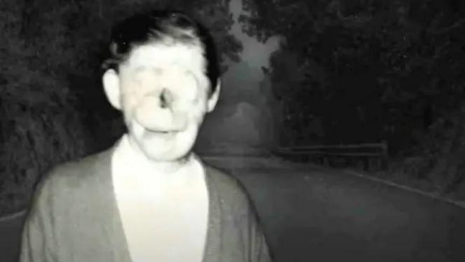 La véritable histoire de Charlie No-Face, l’homme qui a inspiré une ...